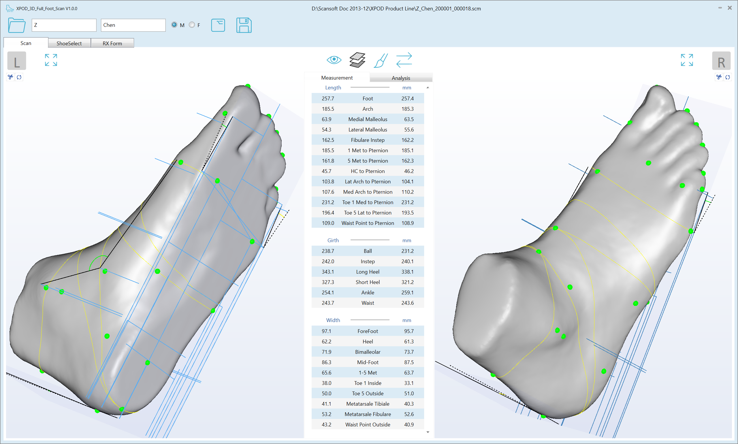 维码科技 | Vismach 3D Laser Foot Scanner | Orthotic Insole CAD & CAM ...