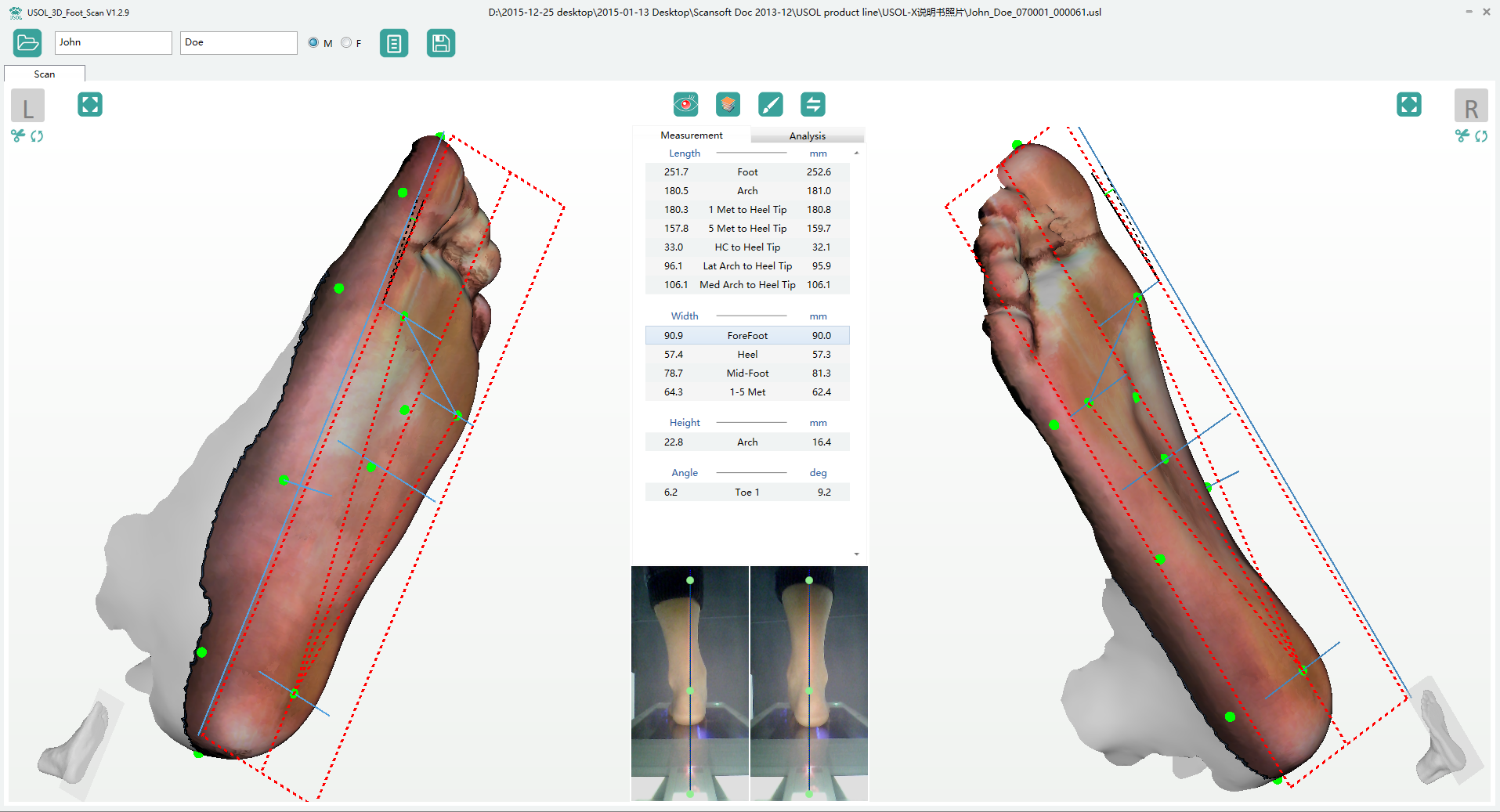 维码科技 | Vismach 3D Laser Foot Scanner | Orthotic Insole CAD & CAM ...